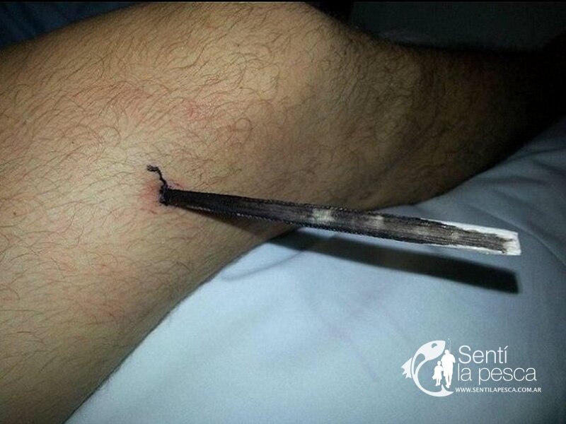 Picadura de Raya - Senti La Pesca